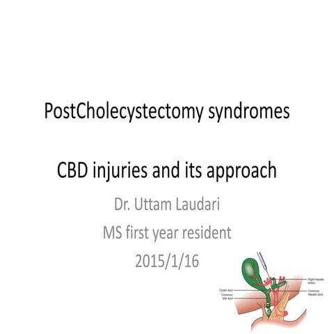 Post cholecystectomy syndromes | PPTX