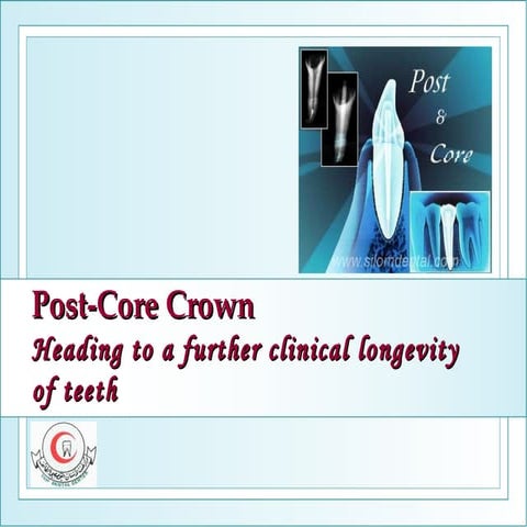 Post core crown | PPT