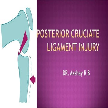 posterior cruciate ligament injury.ppt. . | PPT