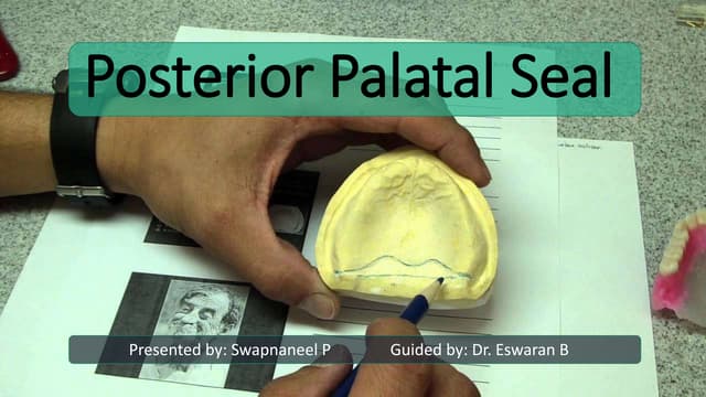 The posterior palatal seal | PPTX