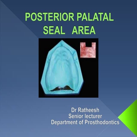 POSTERIOR PALATAL SEAL AREA.pptx