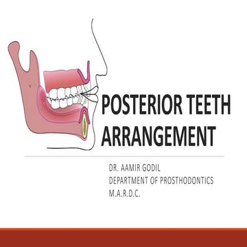 Posterior Teeth Arrangement | PDF