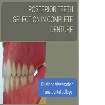 POSTERIOR TEETH SELECTION IN CD.pptx