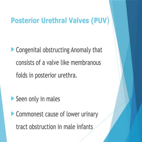 Posterior_Urethral_Valves_Detailed .pptx