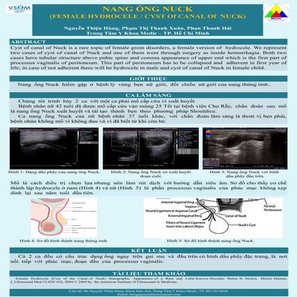 Poster FEMALE HYDROCELE [CYST of CANAL of NUCK], Dr PHAM THI THANH XUAN ...