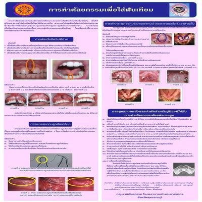 Poster preprosthetic surgery | PDF
