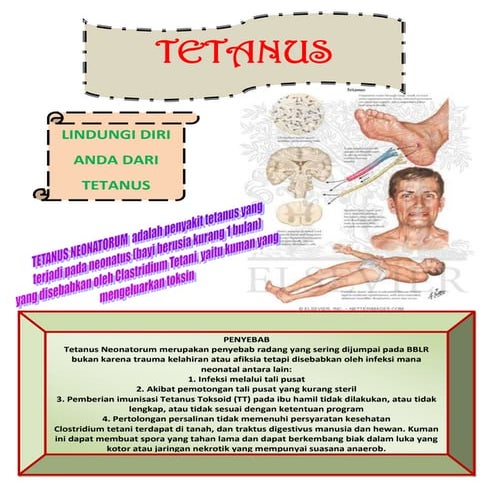 Poster tetanus | DOCX