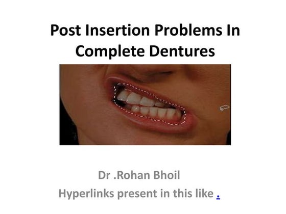 Post insertion instructions in complete denture patients | PPTX | Oral care | Personal Care