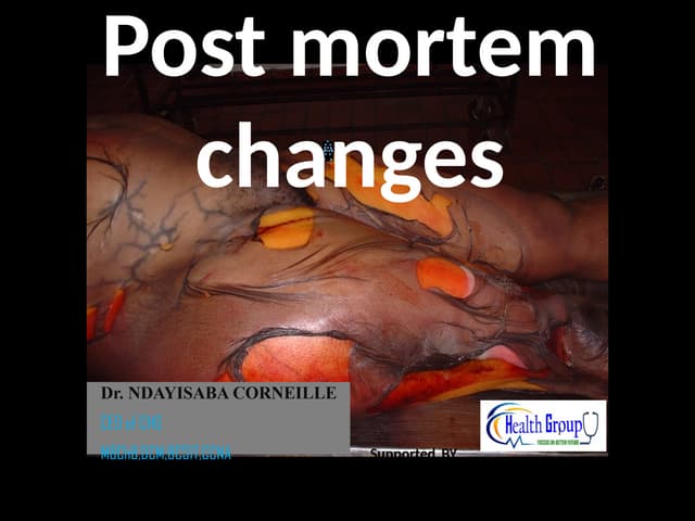 Rigor mortis ppt | PPTX