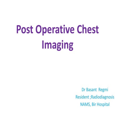 Post operative chest imaging | PPTX