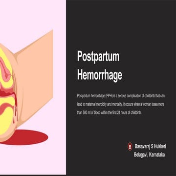 Postpartum-Hemorrhage.pptx