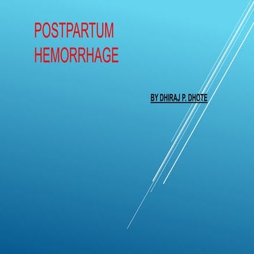 Postpartum hemorrhage.pptx by dhiraj dhote | PPT