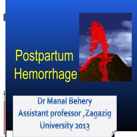 Postpartum hemorrhage for undergraduate | PPT