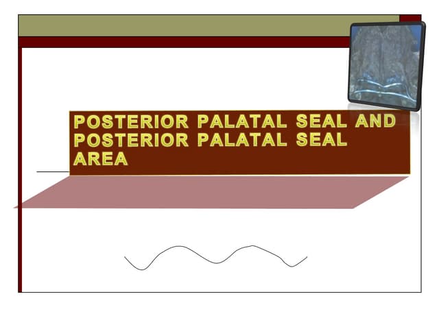 The posterior palatal seal | PPTX
