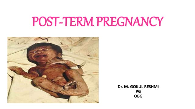 PERIVIABLE BABIES.pptx | Pregnancy | Reproductive Health