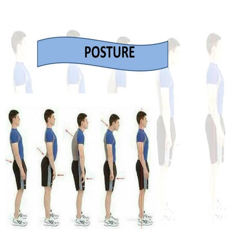Good Posture and Bad posture | PDF