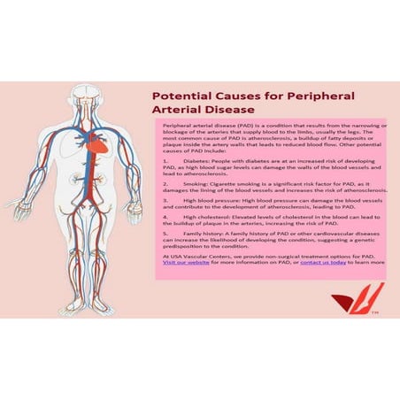 Potential Causes for Peripheral Arterial Disease.pdf | Heart and ...