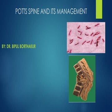 Nonunion definition, causes, classification and management | PPTX