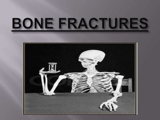 Bone Fractures | PPT