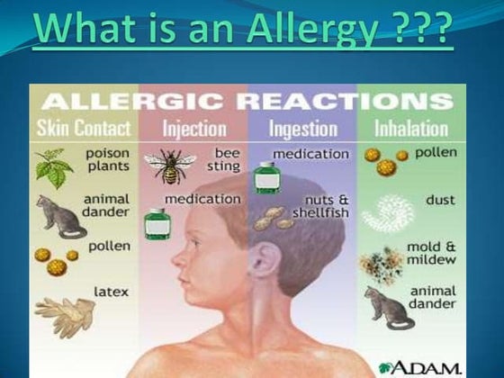 Allergies | PPT