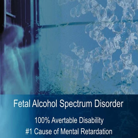 Fetal Alcohol Syndrome Presentation | PPT