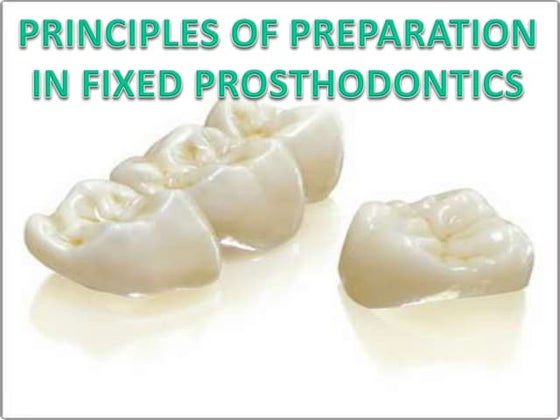 Different gingival finish lines (margins) of crowns and bridges | PPT