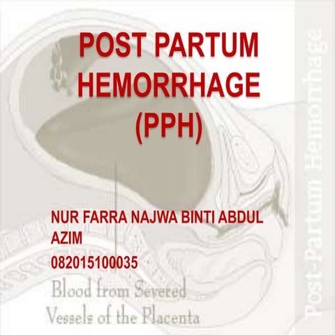 post partum haemorrhage | PPTX