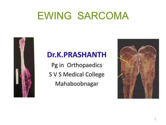 Imaging in rickets | PPT