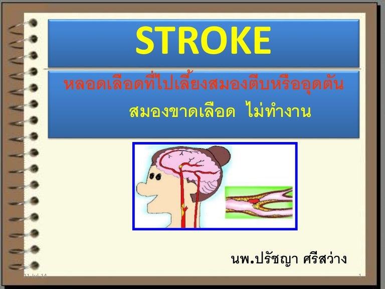 Ppt.stroke