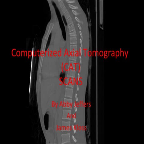 CAT scan 3 | PPT