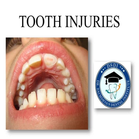 Tooth Injuries| Tooth Trauma| Treatment of Tooth Trauma | PPTX