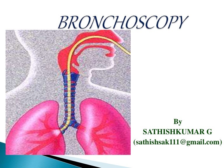 BRONCHOSCOPY
