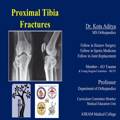 Proximal Tibia Fractures and Its Management.pptx