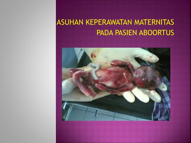 PPT abortus.ppt