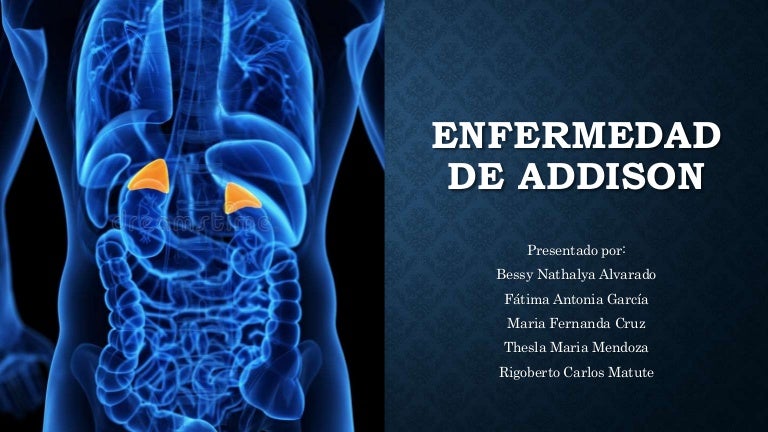 Enfermedad de Addison