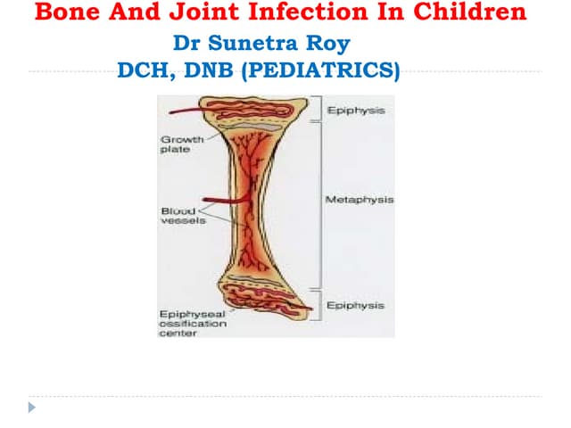 Osteomyelitis | PPTX