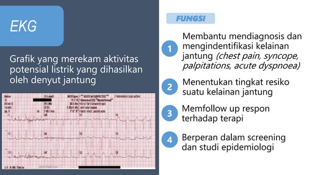 Pengenalan ekg dasar | PPTX