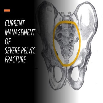 PPT CURRENT MANAGEMENT PELVIC FRACTURE edit.pptx