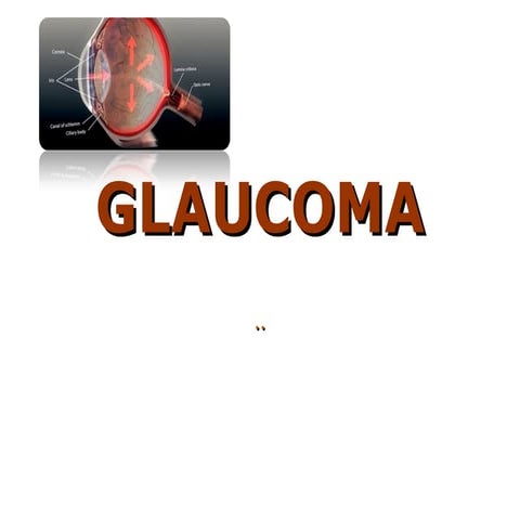 Glaucoma | PPTX