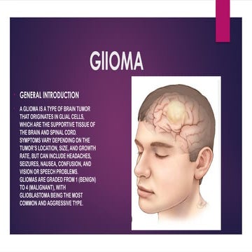 Glioblastoma | PPTX