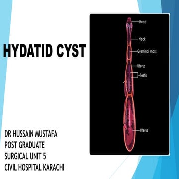 HYDATID cyst.pptx