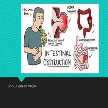 PPT_INSTESTINAL OBSTRUCTION_GI.pptx