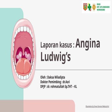 laporan kasus THT PPT Lapsus Angina Ludwig.pptx