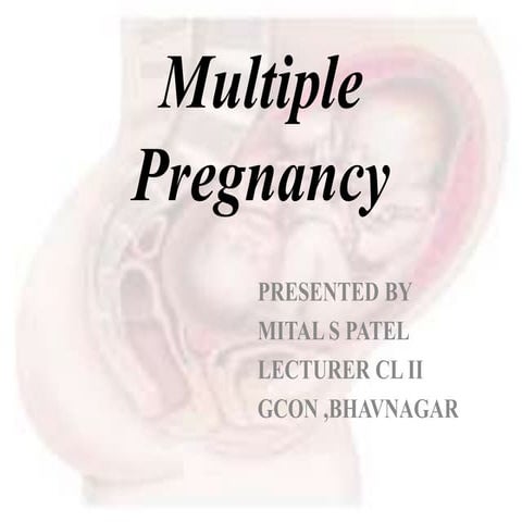 Ppt multiple pregnancy | PPTX