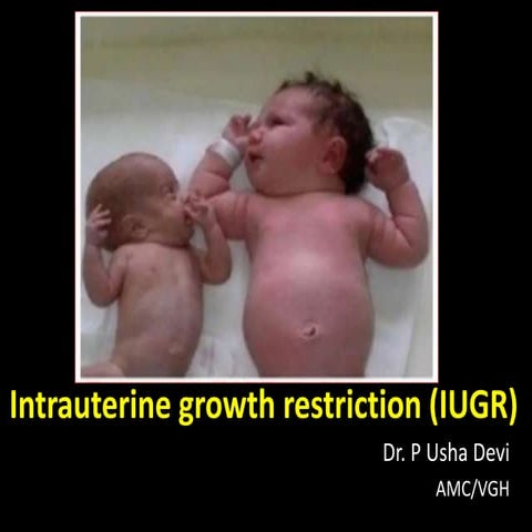 PPT on IUGR .pptx