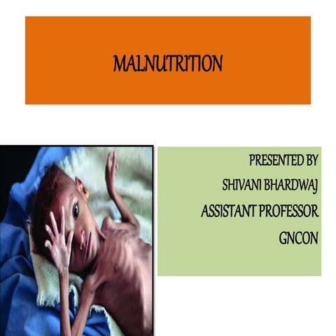 Protein Energy Malnutrition (PEM)- Understanding and Management | PPTX