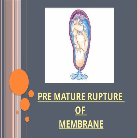 power ponit presentation on repture of membrane | PPTX