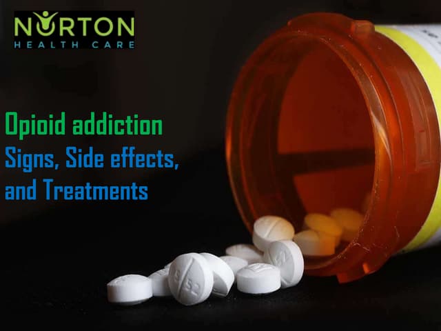 Opioid Addiction Signs, Side effects, and Treatments | PPT Opioid Addiction Signs, Side effects, and Treatments | PPT