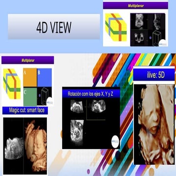 ppt PASOS 4D VIEW pasos para realizar ecografia 4d | PPTX