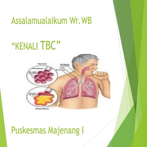 Ppt Penyuluhan Tb Tuberculosis Ppt